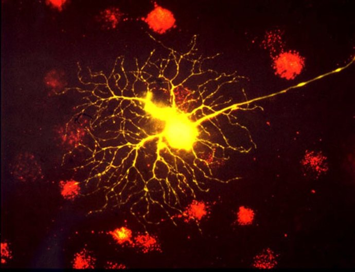 Vytvorili plne funkčné umelé neuróny – Denník N